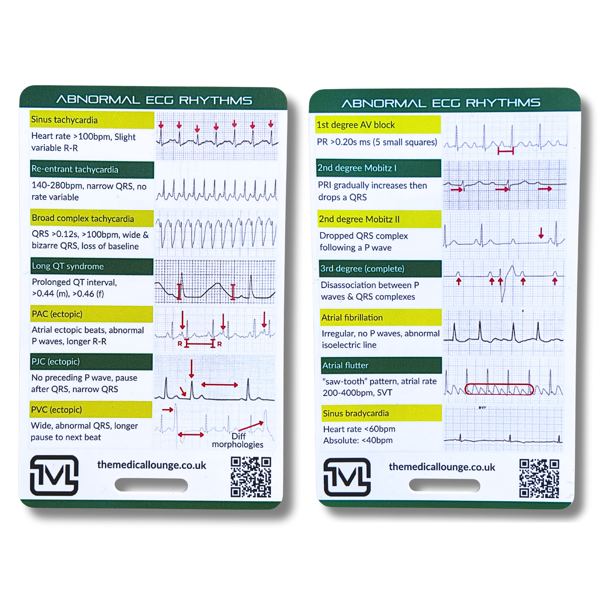 Abnormal ECG Rhythms – Interpretation Reference Card – The Medical ...