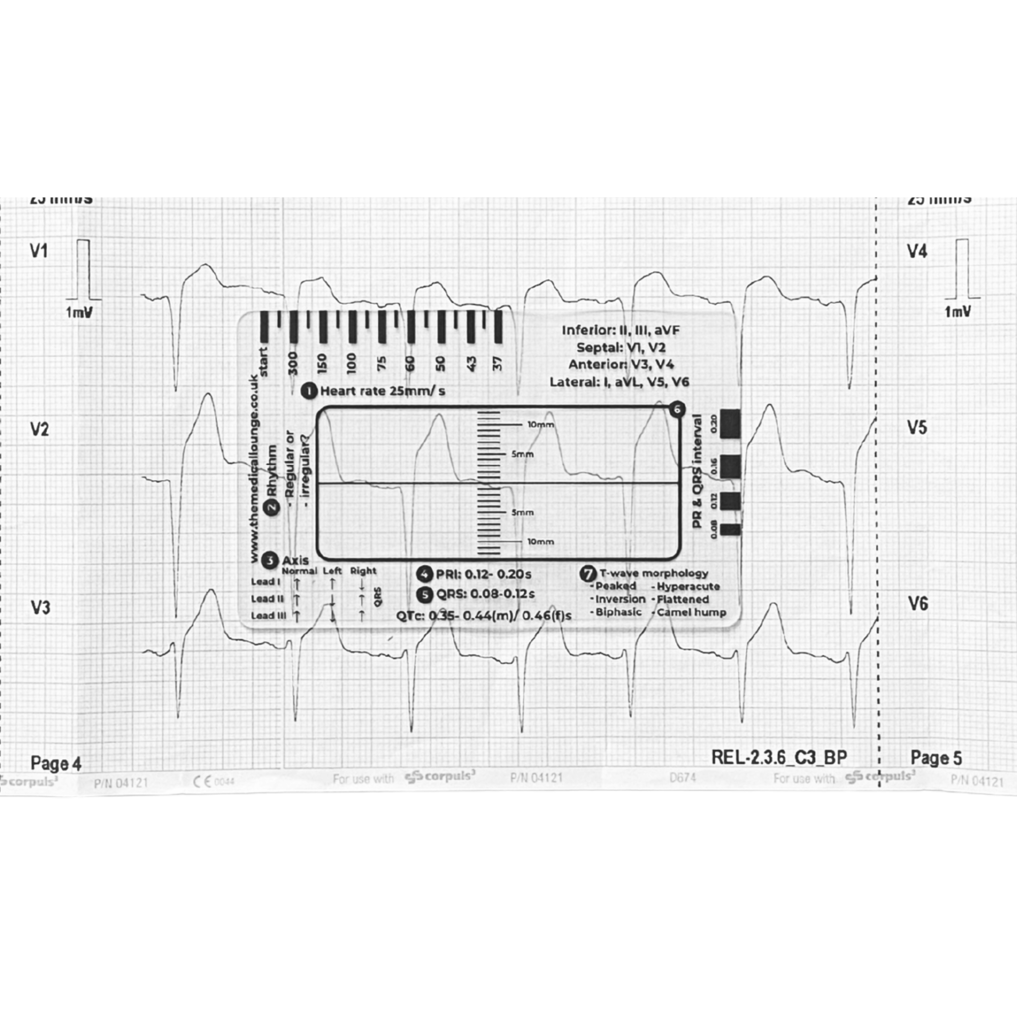 ECG 7-Step Study Ruler – Pocket-Sized Card for Learning ECG Patterns ...